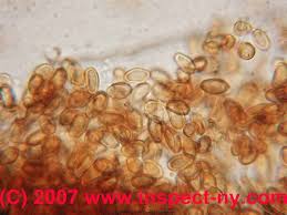 The MOLD THAT EATS HOUSES: MERULIPORIA INCRASSATA